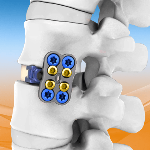 Micro Invasive Technology: Learn about the Life Spine Difference